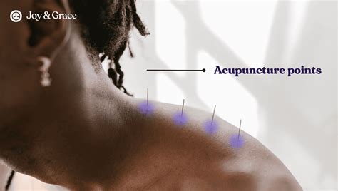 Chinese And Modern Views On Acupuncture For Shoulder