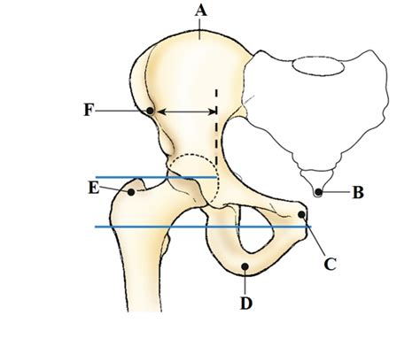 Bony Landmarks And Localization Planes Of Pelvis Diagram Quizlet