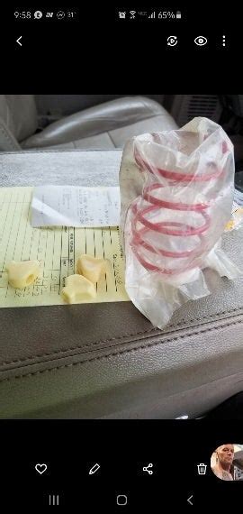 Need Help With 2001 Xplorer Transmission Issues Polaris Atv Forum