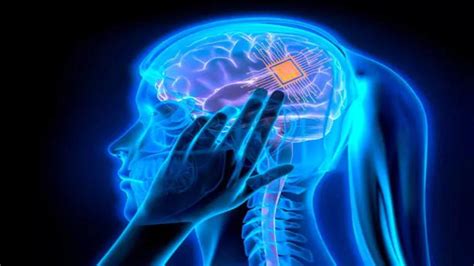 La ciencia ficción se ha hecho realidad Un chip Neuralink ha permitido