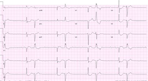 1 Good Morning Medtwitter And Welcome To Another Round Of