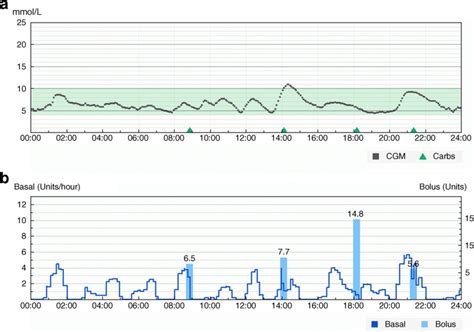 Hybrid Closed Loop Glucose Control A 24 H Of Sensor Glucose Data Download Scientific