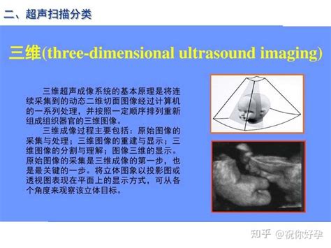 超声成像的基本原理 知乎