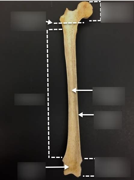 Bone Structure Diagram Quizlet