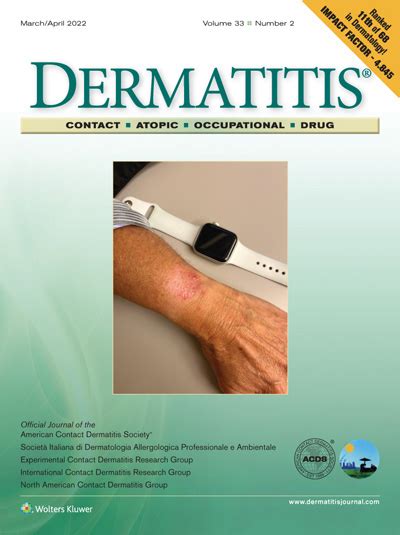 Contact Leukoderma Caused By Buspirone Patches American Journal Of Contact Dermatitis