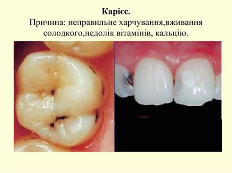 здорові зуби Ppt