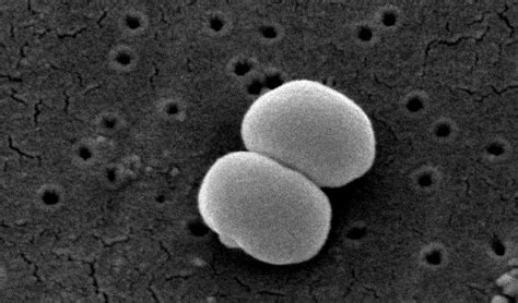 Staphylococcus Epidermidis And Staphylococcus Saprophyticus Howmed