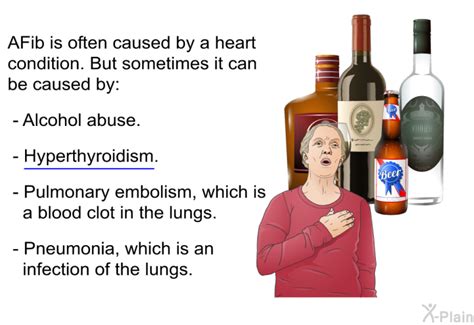 Cardiac Ablation For Atrial Fibrillation