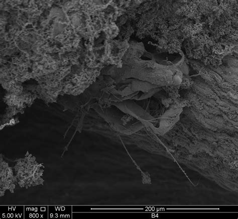 Scanning Electron Micrograph Of Beauveria Bassiana Bb4 Isolates