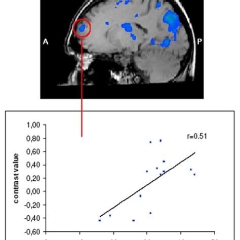 Activation In The Left Superior Frontal Gyrus Was Associated With Download Scientific Diagram