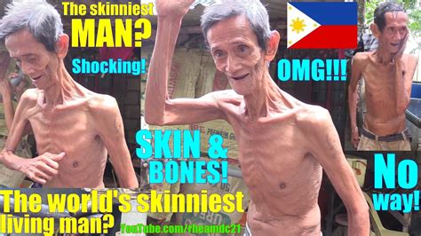 Skinniest Kid In The World Youtube