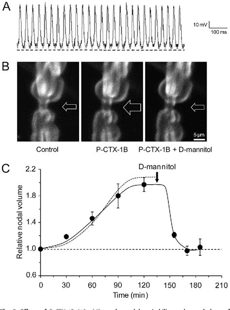 Axonal Swelling Semantic Scholar