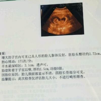 肾结石b超图 怎样看懂肾结石b超图 肾结石图片 大山谷图库