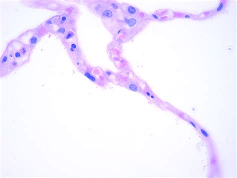 Pneumocytes