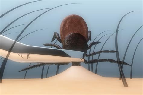 Insect Bites And Stings Nhs