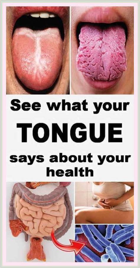 What Your Tongue Is Trying To Tell What Is Health Tongue Health