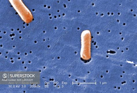 At A Magnification Of 20863x This Colorized Scanning Electron Micrograph Sem Revealed Two