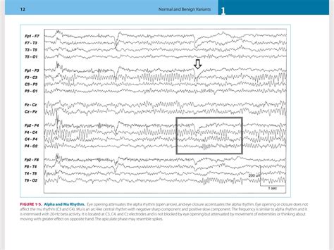 Figure 15 Alpha And Mu Rhythm Eye Opening Attenuates The Alpha