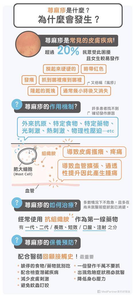 蕁麻疹如何治療保養與預防醫師圖文完整說明 美的好朋友