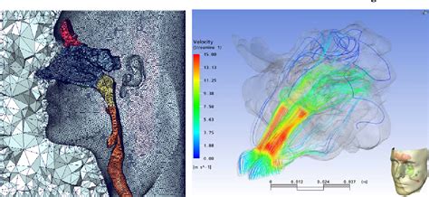 Figure 2 From Understanding Nasal Airflow Via Cfd Simulation And