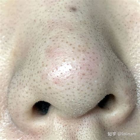 黑头的图片配图网
