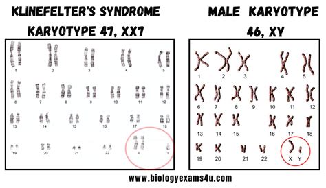 What Is A Karyotype Called