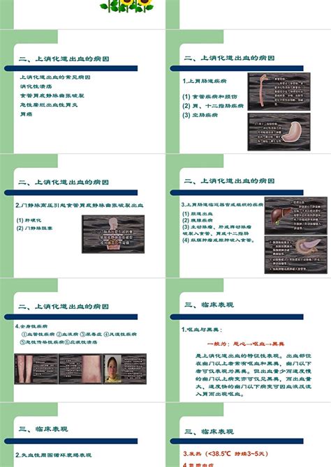 Ppt