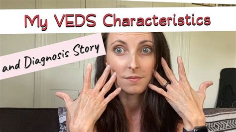 Acrogeria Vascular Ehlers Danlos Veds Premature Aging Of Skin Vascular Ehlers Danlos Syndrome