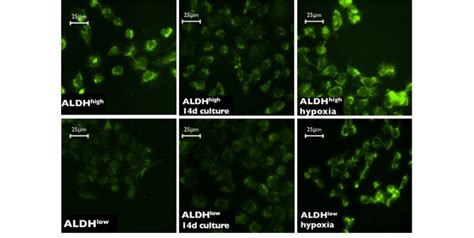 Aldehyde Dehydrogenase Isoform 1 Aldh1 A1 Immunofluorescence Analysis