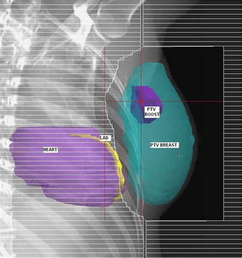 Beam S Eye View The Best Picture Of Beam