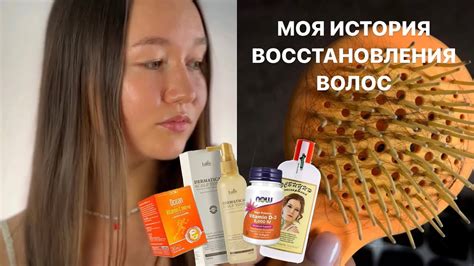КАК ОСТАНОВИТЬ ВЫПАДЕНИЕ ВОЛОС?| витамины, уход и новые привычки для ...