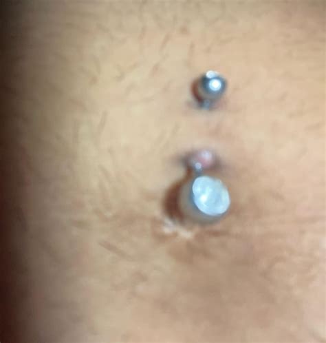 Is My Belly Piercing Infected Rpiercingadvice