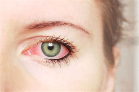 Retinopatia Cukrzycowa Klinika Gda Pl
