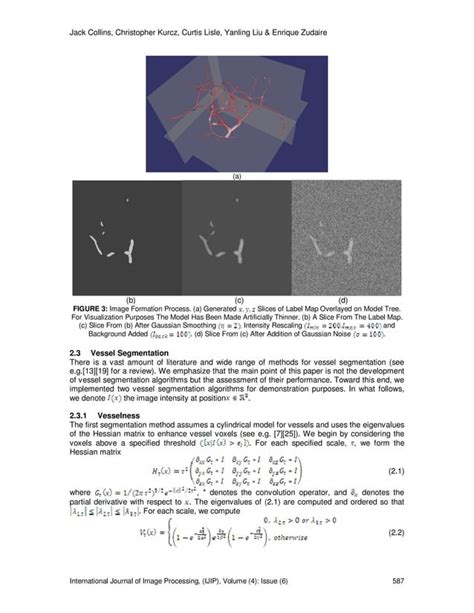 Assessment Of Vascular Network Segmentation Pdf Graphics Software