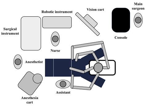 Video Robot Assisted Total Mesorectal Excision And Lateral Pelvic