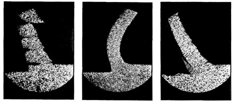 “1g 1 The Three Basic Chip Types According To Ernst Type