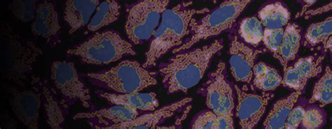 High Content Analysis Hca