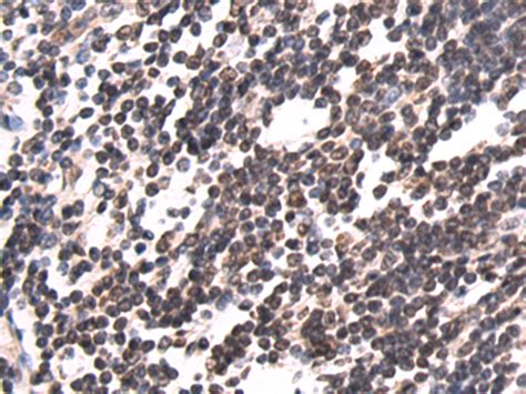 兔抗col1a2多克隆抗体anti Col1a2 Rabbit Polyclonal Antibody 生命科学产品与技术服务 生工生物工程