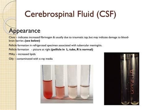 PPT CEREBROSPINAL FLUID BY Hossam HASSAN PowerPoint Presentation