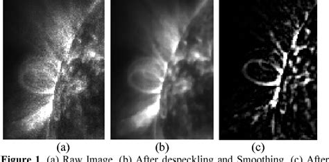figure 1 from principal contour extraction and contour classification