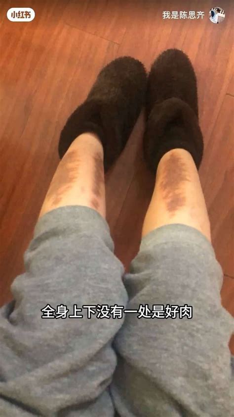 43歲前tvb「御用丫鬟」陳思齊慘況曝光 被好友騙走畢生積蓄 晒恐怖爛面照：瘦到得番七十幾磅！