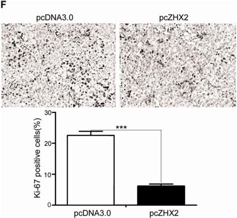 Elevated ZHX2 Levels Inhibit Growth Of HCC Both In Vitro A B And In