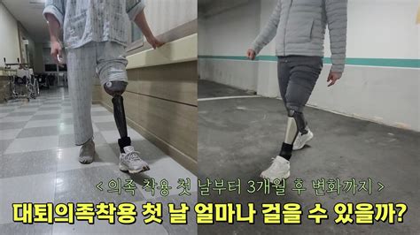 대퇴의족 착용 첫 날 얼마나 걸을 수 있을까 씨렉4 착용 첫날~3개월후 Youtube