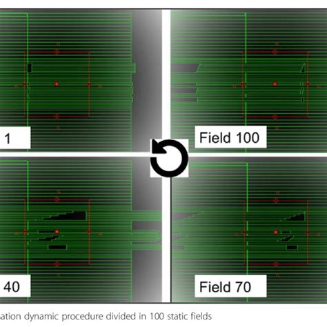 A Picket Fence Test For The Elekta 80 Leaf Mlc Using A 2 Mm Gap The Download Scientific