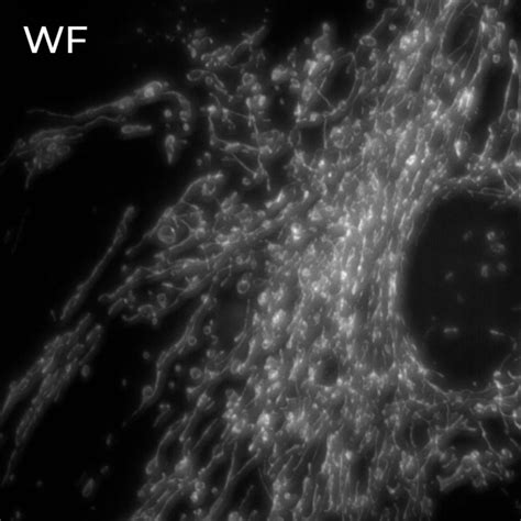 Breaking The Diffraction Limit Discovering Cellular Organelles With