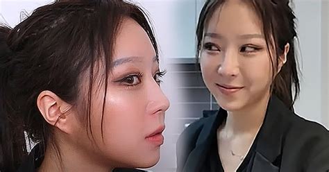 “엄마도 못 알아봐” 성형 후 180도 달라진 얼굴로 등장…놀라움 안긴 방송인