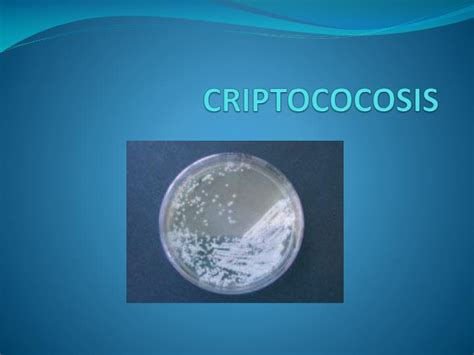 Ppt Criptococosis Powerpoint Presentation Free Download Id948509