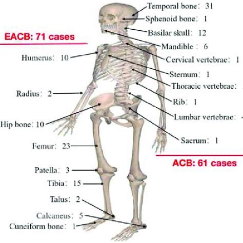 Chondroid Type Matrix With Chicken Wire Calcification Arrow He ×20 Download Scientific Diagram