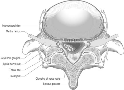 Neural Scarring Musculoskeletal Key