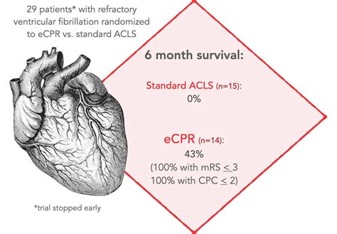 Article Bites 27 Is Ecpr The Future Of Refractory Vfib Management Naemsp